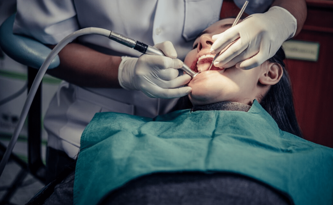 Composite Tooth Filling Bali | Kalm Dental Care